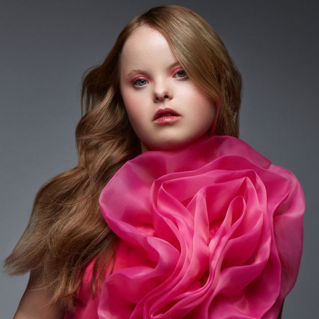 Down's syndrome: Model 'changing the face of fashion' - BBC News