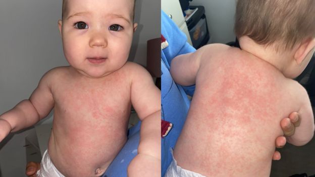 Antibiotics: Mum told to crush up pills for strep A baby - BBC News