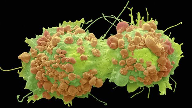 Turning cancer back into healthy tissue - BBC News