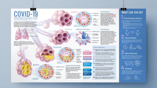 International Women's Day: Illustrating the Covid-19 pandemic - BBC News