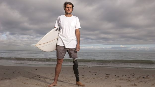 Shark attack survivor wins right to keep tooth left in surfboard - BBC News