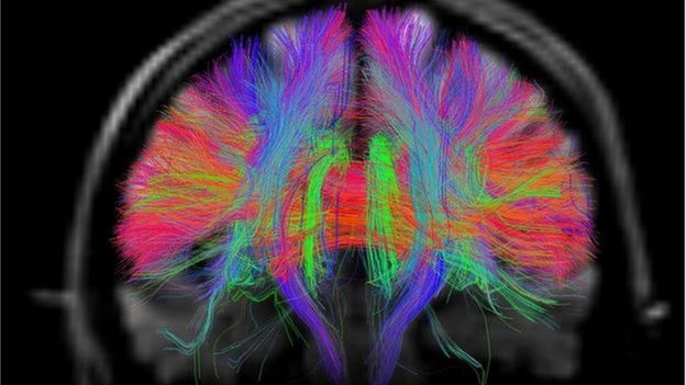 Lab-grown brain cells play video game Pong - BBC News