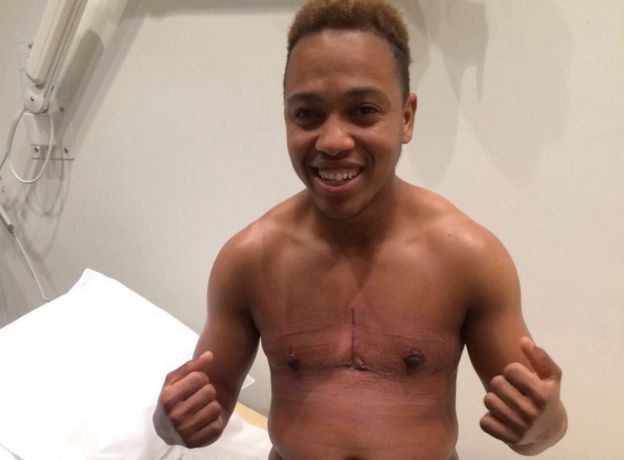 'The first surgical procedure is key moment in a trans male's life ...