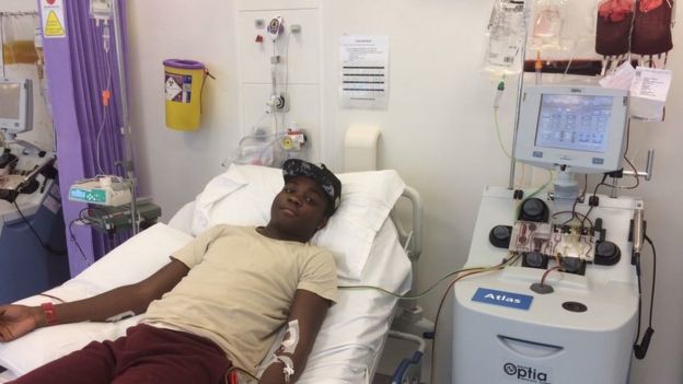 Tracing sickle cell back to one child, 7,300 years ago - BBC News