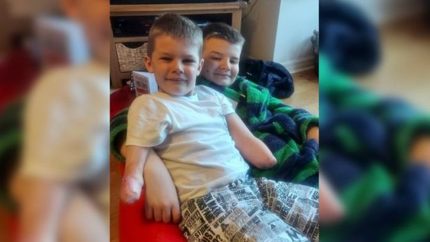 Luke Mortimer: Aim to give Skipton boy who lost limbs 'best life' - BBC ...