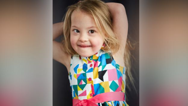 Downs Syndrome In All Honesty We Were Offered 15 Terminations Bbc