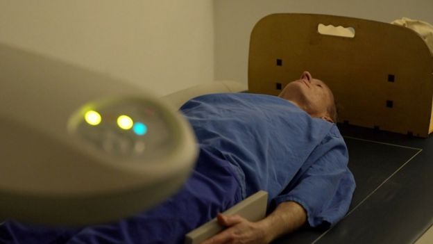 Ageing body scans to aid understanding of why diseases occur - BBC News