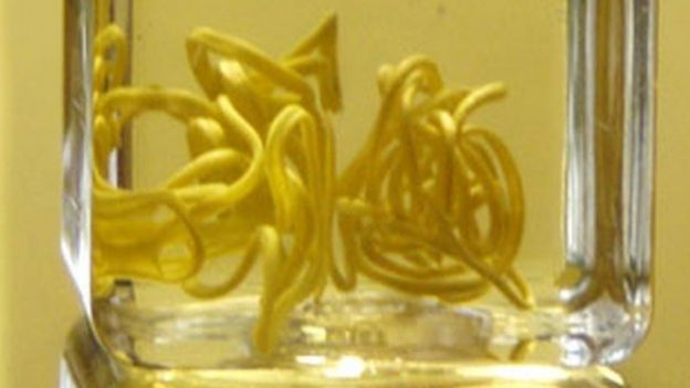 President Carter vs Guinea Worm - BBC News