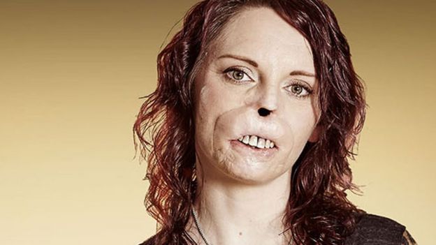 My fear of dating as someone with dwarfism - BBC News