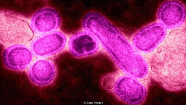 Penyakit flu yang mengubah abad ke-20: Menghilangkan satu generasi dan ...