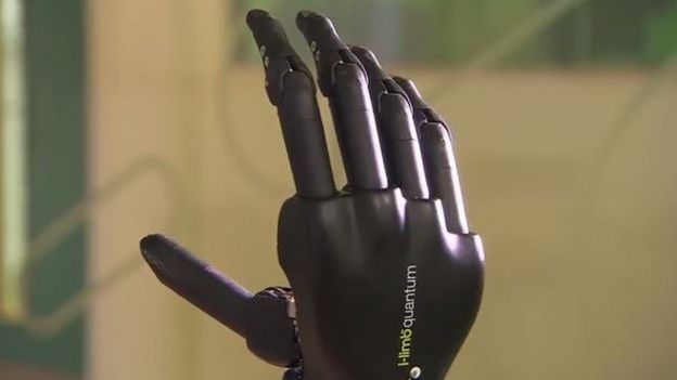 Touch Bionics sold to Icelandic firm Ossur - BBC News