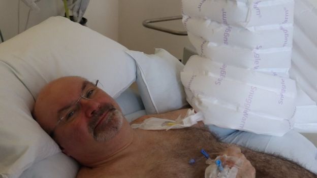 Man has hand reattached after 'horrific' machine accident - BBC News