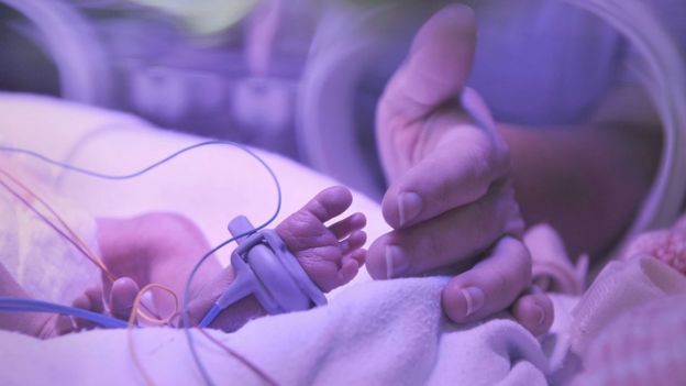 Baby deaths: MPs tell of pain and trauma of their loss - BBC News