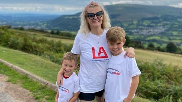 Sepsis: 'My life changed eight years ago on Christmas Eve' - BBC News