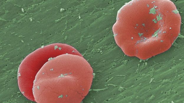 SC Genotype meaning: Blood group types and gene example of pipo wey dey ...