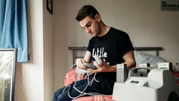 What's it like to live with a mechanical heart pump? - BBC News