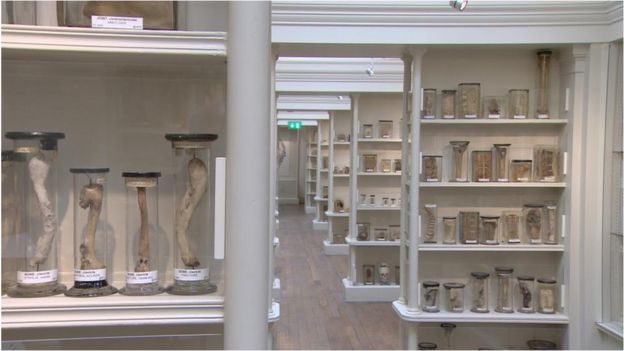 Edinburgh's Surgeons' Hall Museums reopens after £4m revamp - BBC News