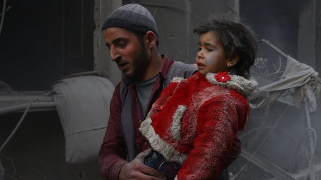 Syria war: Eastern Ghouta bombing 'catastrophic' - BBC News