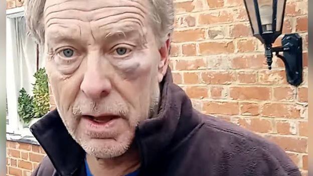 Maldon district councillor and leader's husband in altercation - BBC News