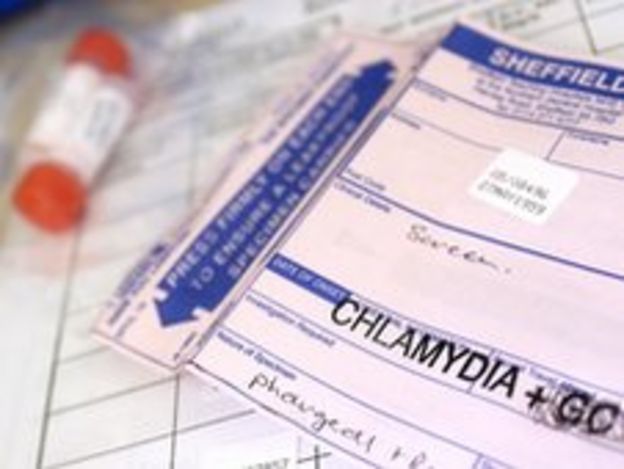Women should get chlamydia test 'after every partner' - BBC News