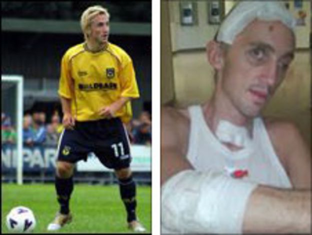 Footballer attack accused lose Greece extradition fight - BBC News