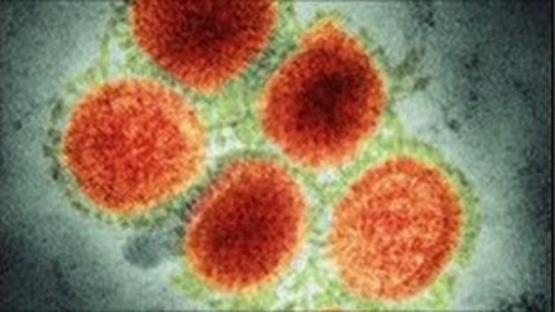 Swine flu warning to pregnant women in Northern Ireland - BBC News