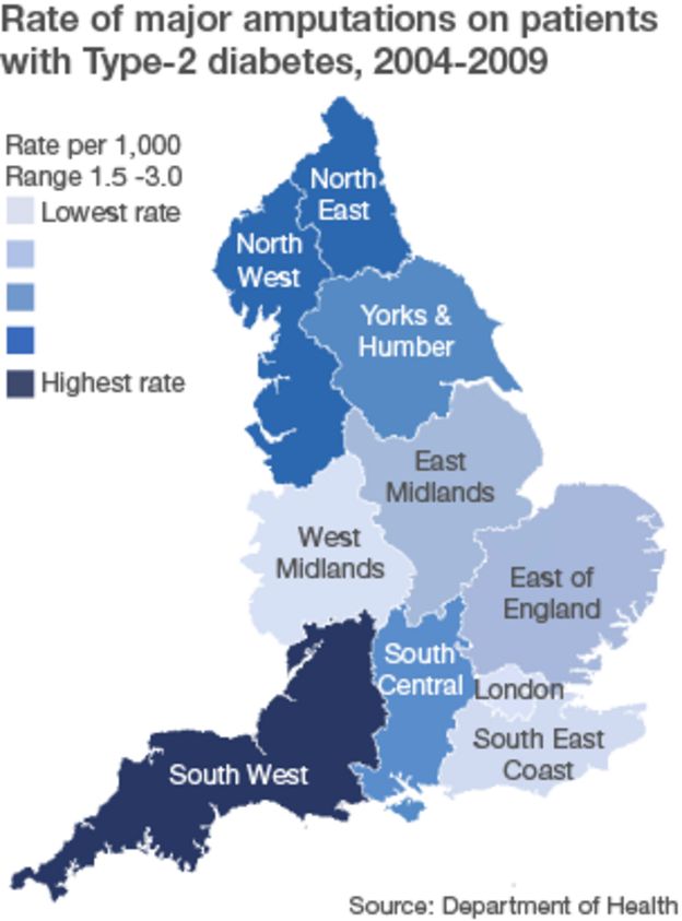 Variation in amputation rate 'shocking' - BBC News