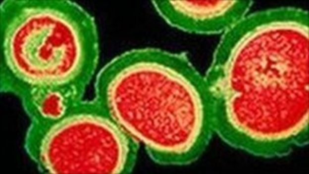 MRSA superbug death total 'continues to fall' - BBC News