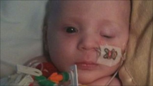 Probe into meningitis baby's care at Kent hospital - BBC News