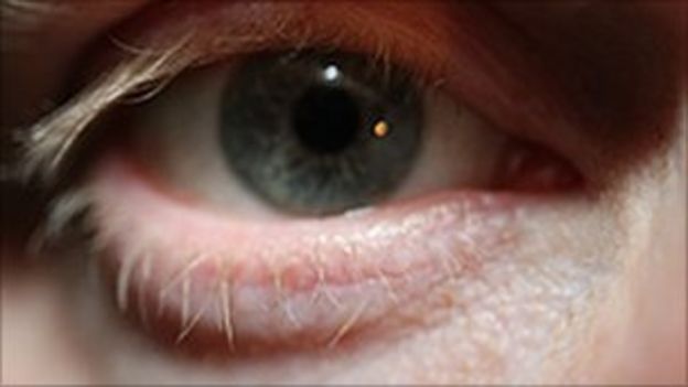 Scotland's free eye tests 'benefiting rich more than poor' - BBC News