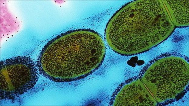 Scarlet fever: Highest number of cases in 20 years - BBC News