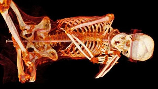 Scans bring new insights into lives of Egyptian mummies - BBC News