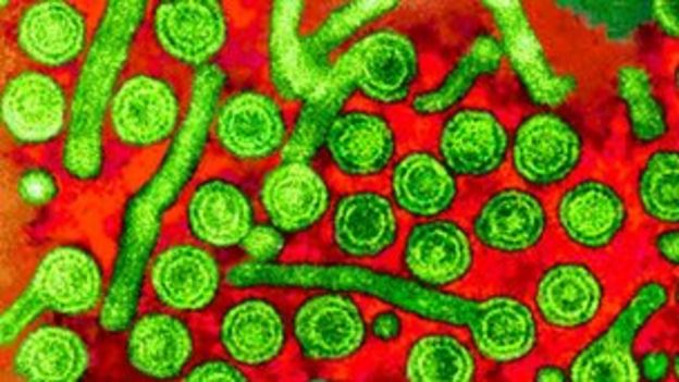 Aintree Hospital patients contacted over virus - BBC News