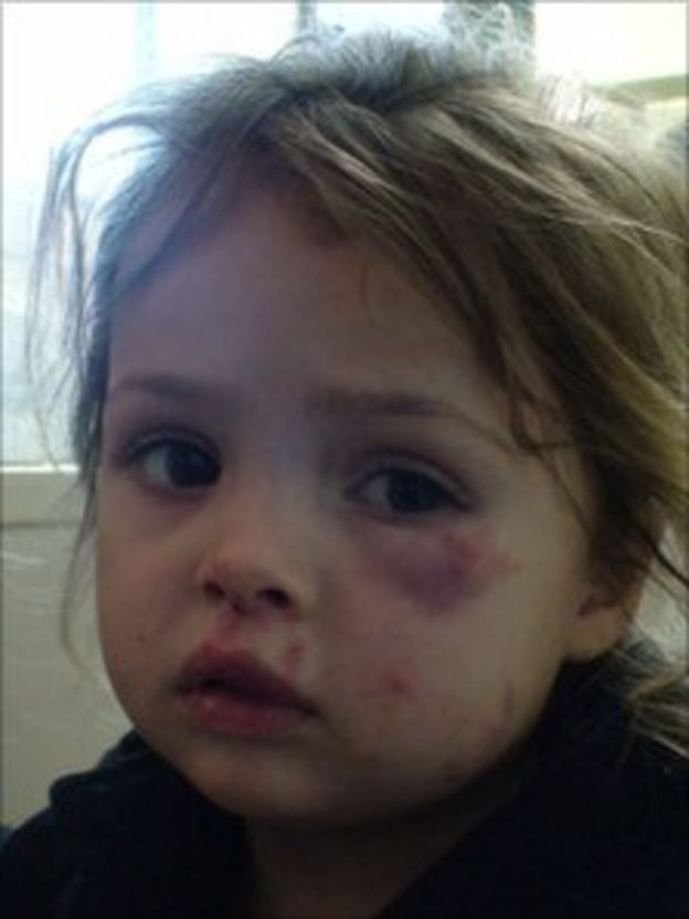 Three-year-old girl 'injured in attack at Ratby nursery' - BBC News