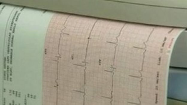 Cry charity's Penzance heart screening for young people - BBC News