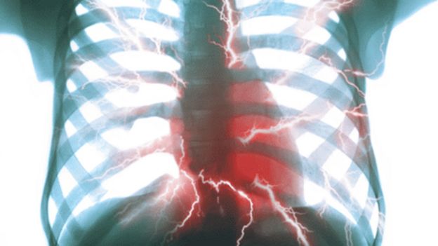 Can stem cells heal broken hearts? - BBC News