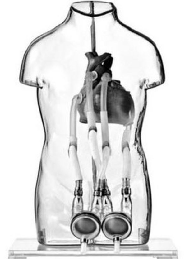 Artificial heart keeps boy alive for record 251 days - BBC News