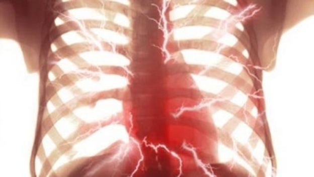 Elite athletes should get heart screening, says expert - BBC News