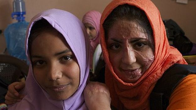 Fixing bodies broken in years of Arab world violence - BBC News