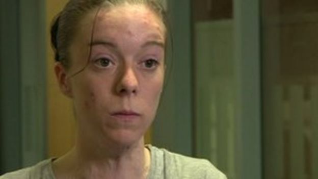 Woman set on fire speaks out about domestic violence - BBC News