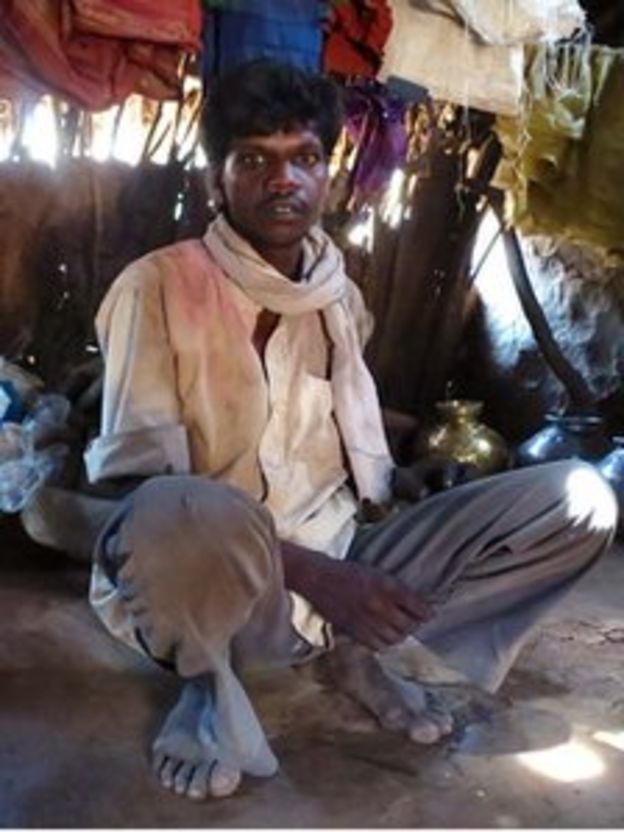 India’s enduring problem with malnutrition - BBC News