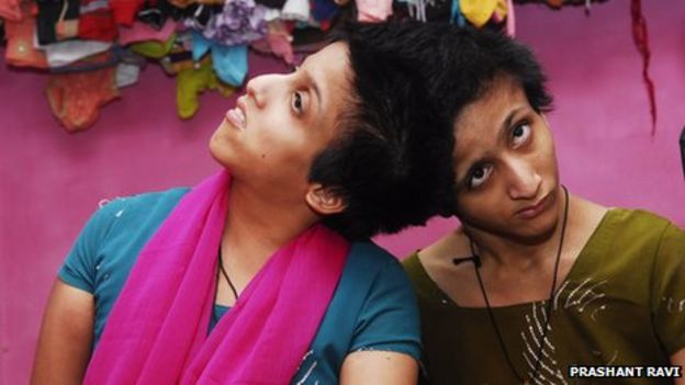 India conjoined twins face uncertainty - BBC News