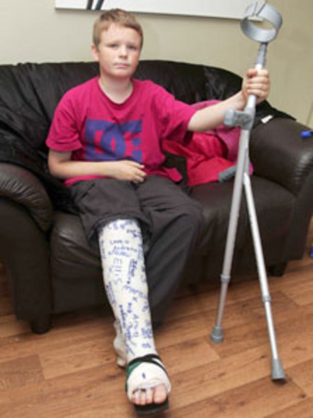 Propeller leg boy Cian Wyn Williams has 700 stitches - BBC News