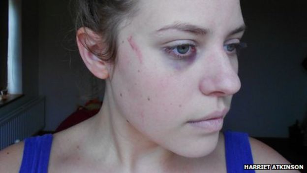 Harriet Atkinson 'disgusted' over CPS witness error - BBC News