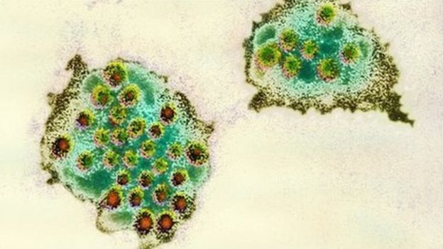 'Cold plasma' kills off norovirus - BBC News