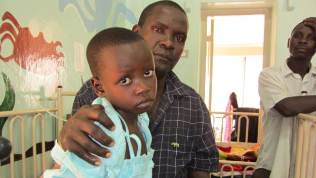 Surviving cancer in a country with no radiotherapy machine - BBC News