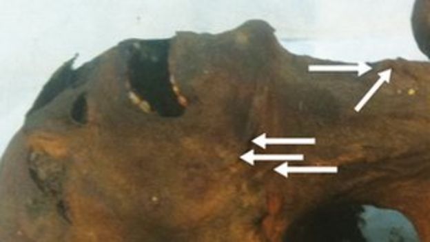 King Ramesses III's throat was slit, analysis reveals - BBC News