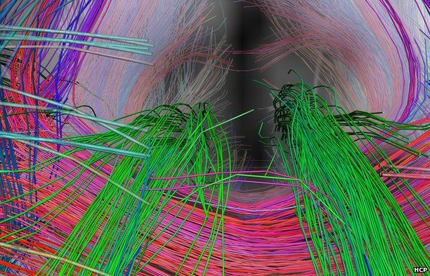Scans reveal intricate brain wiring - BBC News