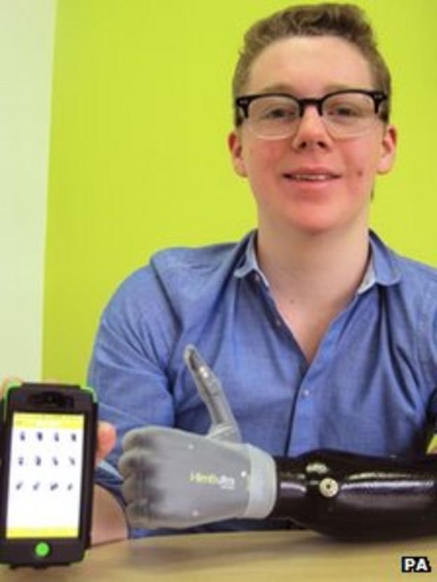 London teenager gets mobile app-controlled 'bionic arm' - BBC News