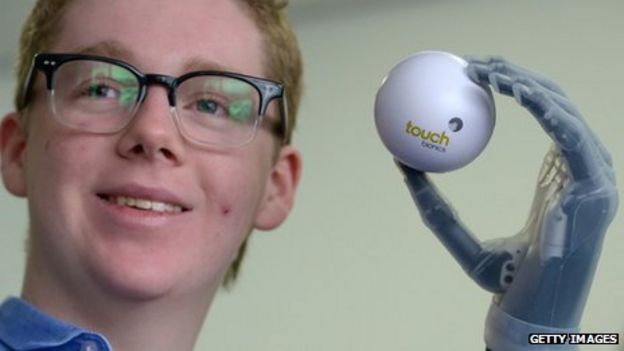 London teenager gets mobile app-controlled 'bionic arm' - BBC News
